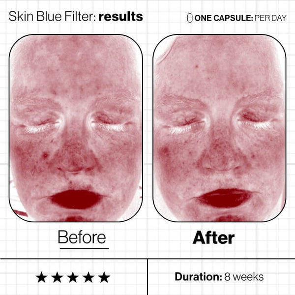Advanced Nutrition Programme Skin Blue Filter – Chelleon